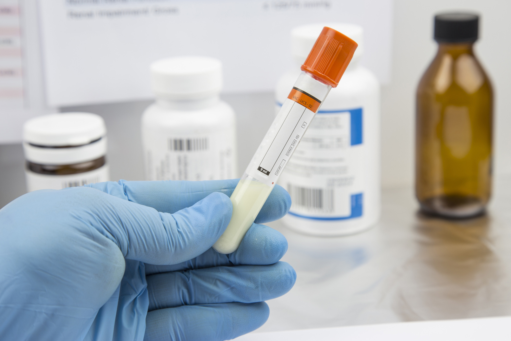 ¿Cómo interpretar un seminograma? | Clínica Eugin